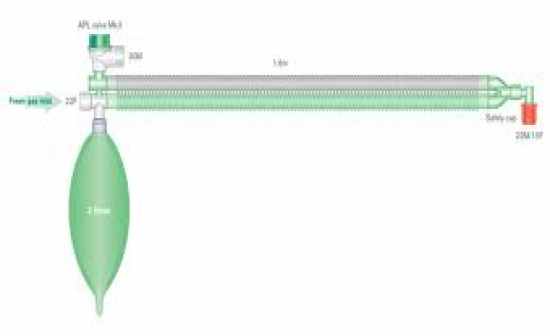 Anaesthetic Breathing Systems Flashcards Flashcards by ProProfs