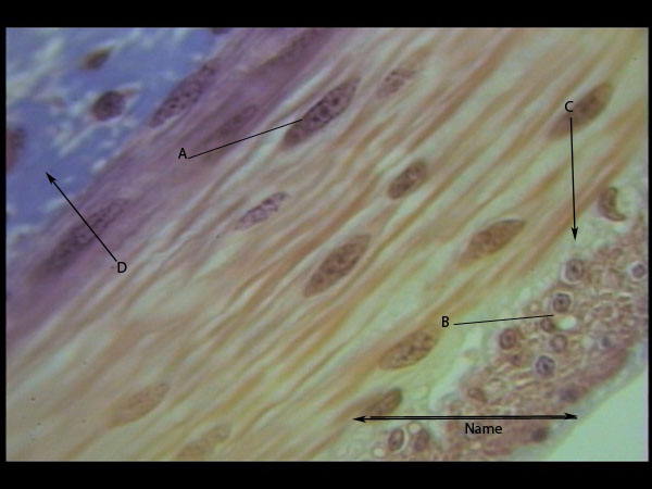 Cardiac Muscle Tissue Identification Quiz - Quiz, Flashcards & Trivia